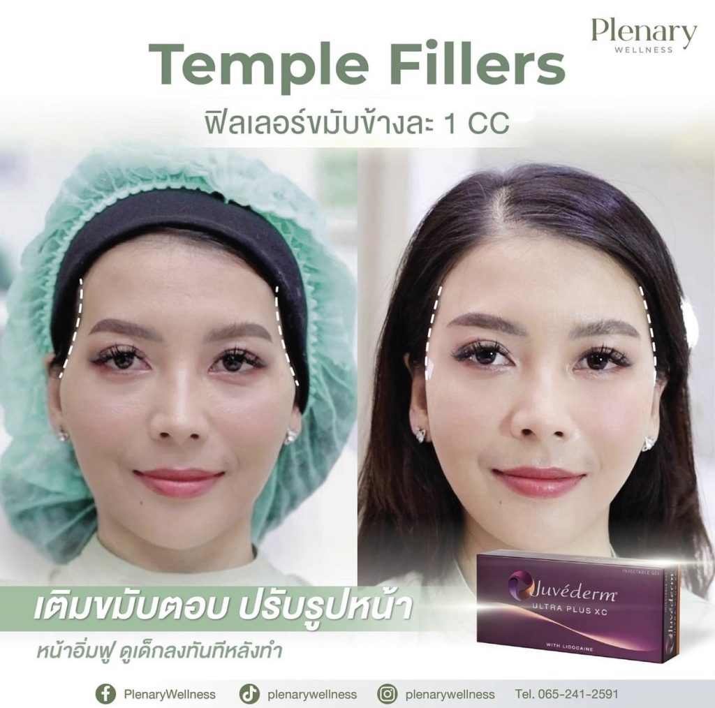Fillers - Plenary Wellness